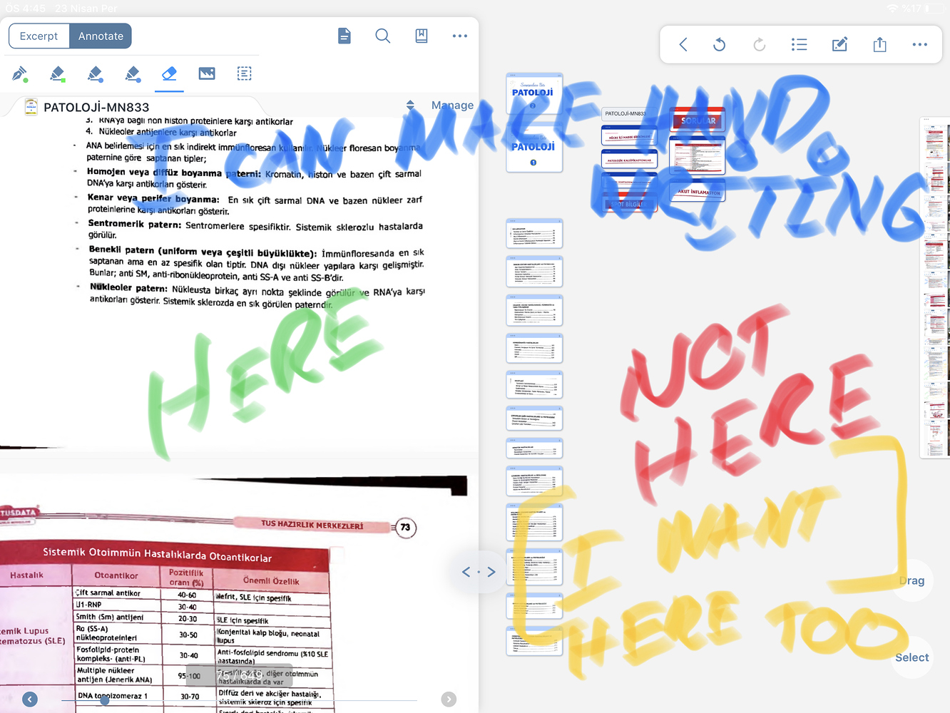 Handwriting ON MİNDMAP - Feature Requests - Marginnote
